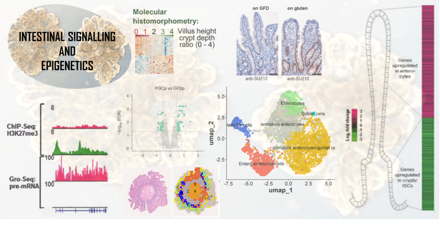 Research | Intestinal Signalling and Epigenetics (ISE) | Tampere ...